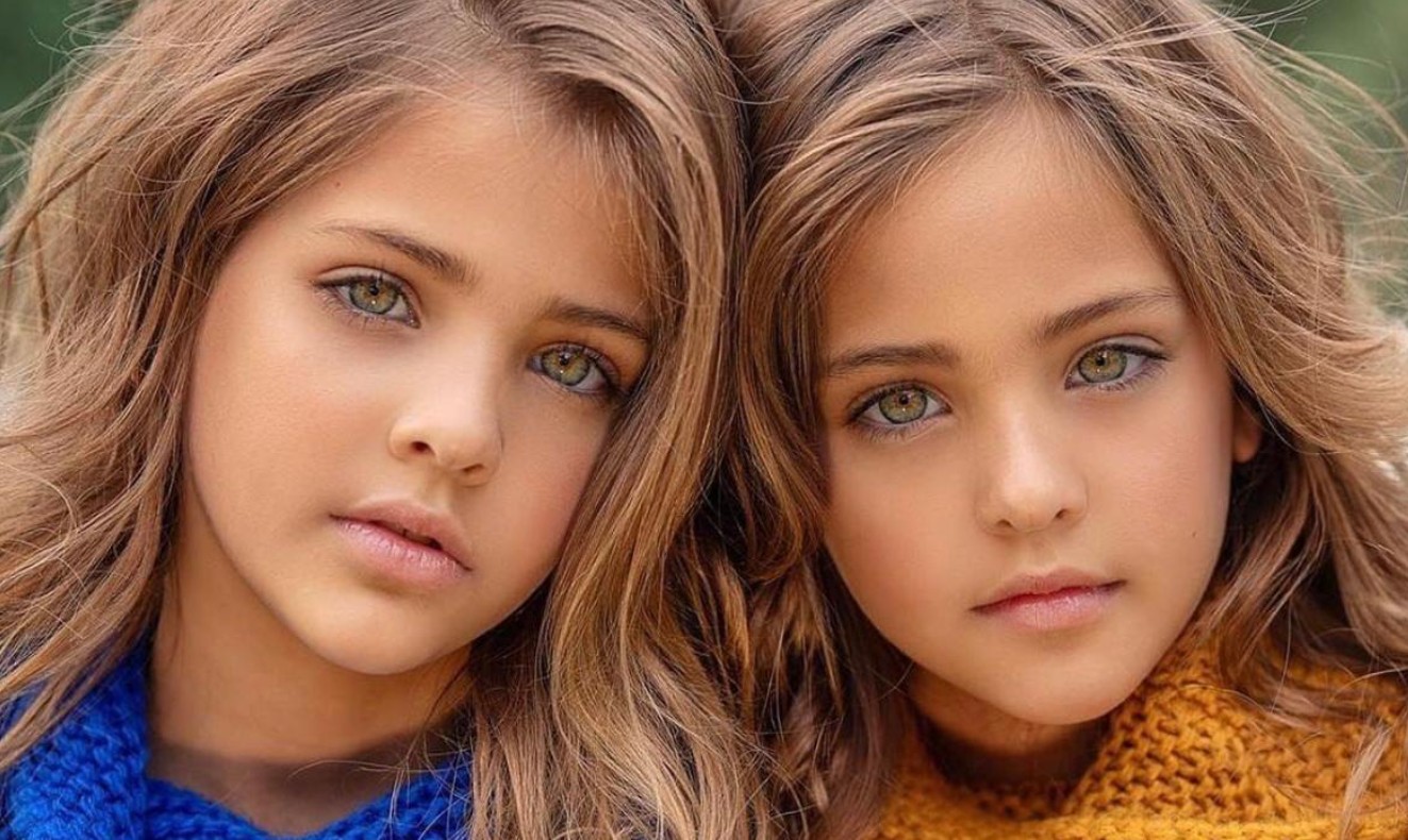 Así lucen ahora Leah y Ava, las gemelas "más hermosas del mundo"